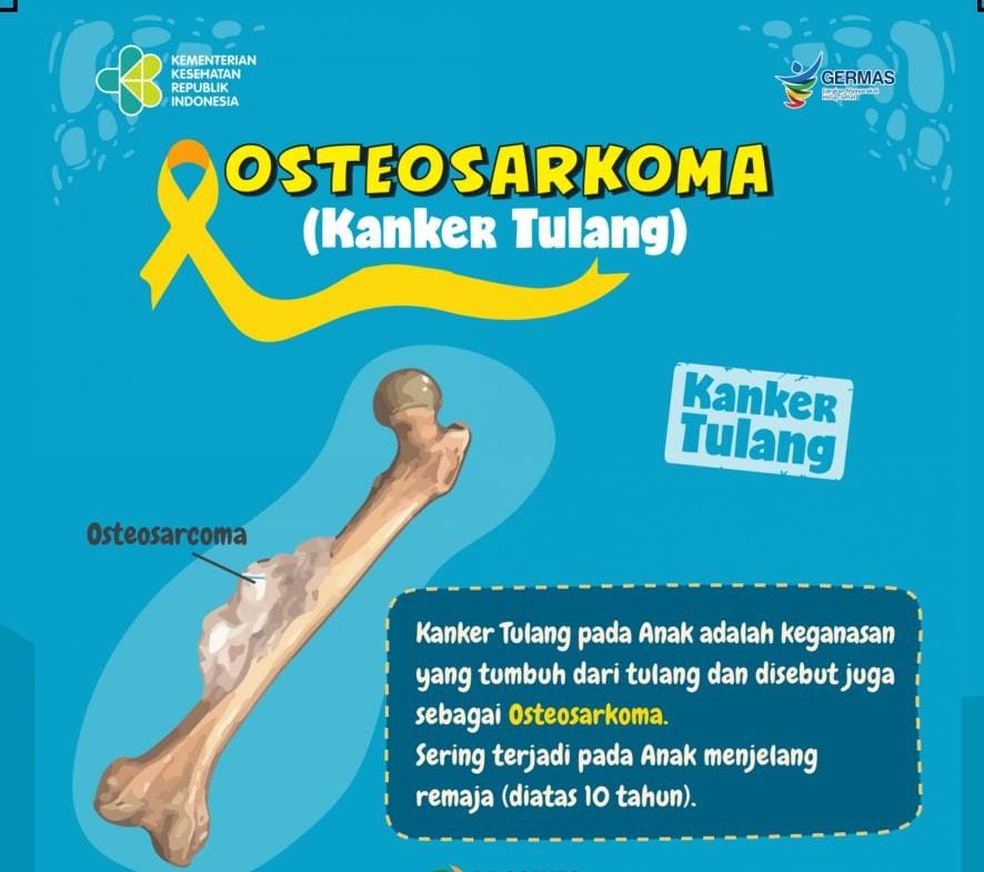Dinkes inhil Ajak Masyarakat Edukasi Kanker Tulang